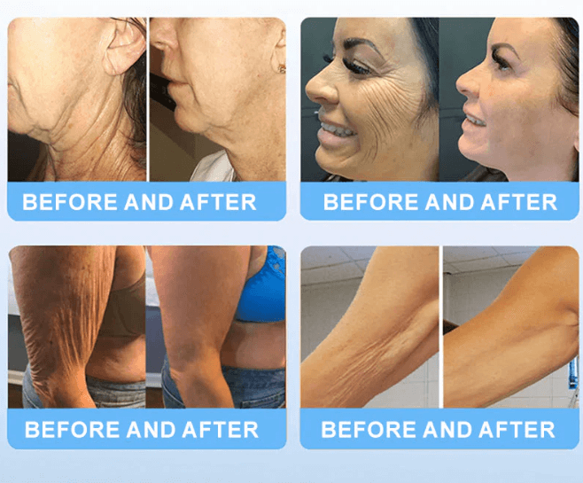 Advanced Retinol Skin Firming Stick – Nevora